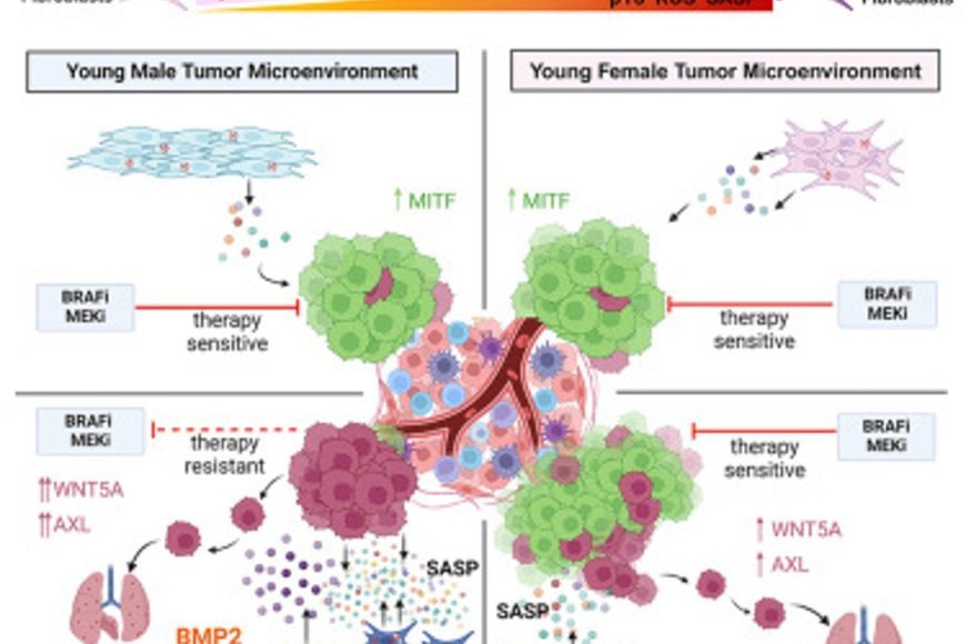 Sex Disparity In Cutaneous Melanoma Sciencemission 5947