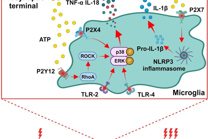 Neuroimmune interactions in migraine headache - Sciencemission Neuroimmune interactions in migraine headache - Sciencemission