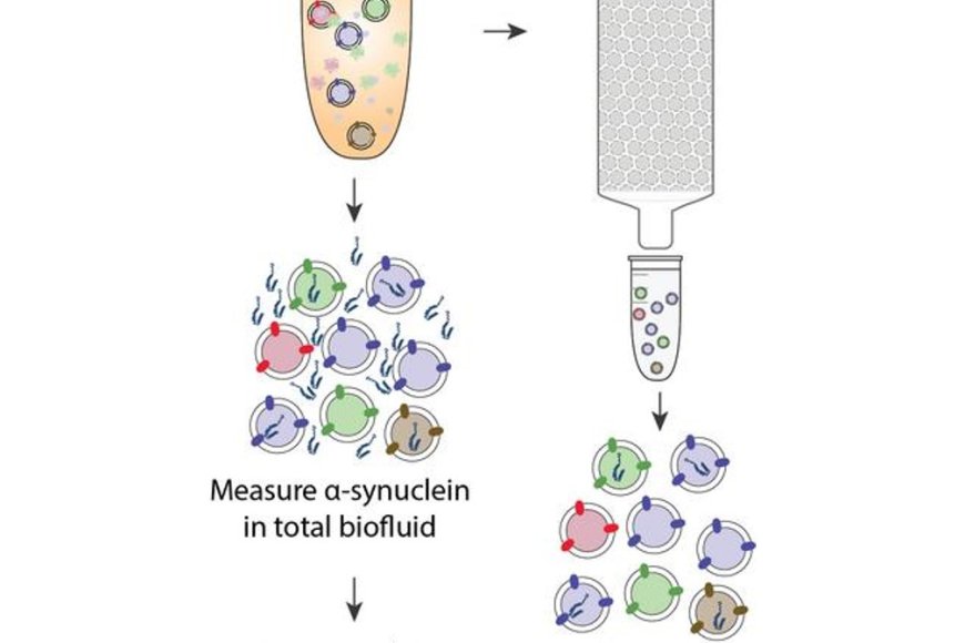 Measurement of α-synuclein in plasma extracellular vesicles ...