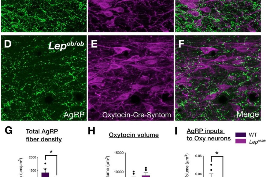AgRP neurons mediate activity-dependent development of oxytocin ...