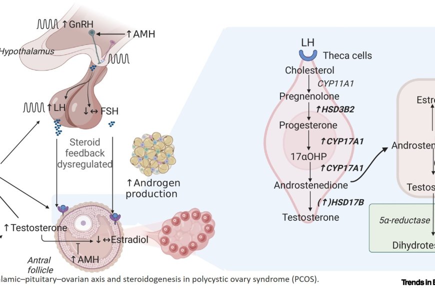 Polycystic ovary syndrome (PCOS) inheritance! - Sciencemission