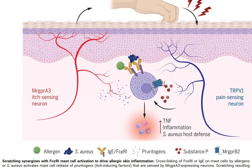 How scratching promotes allergic inflammation - Sciencemission
