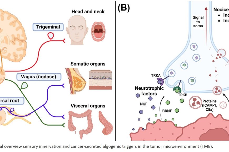 Sensory neurotransmission and pain in solid tumor progression ...