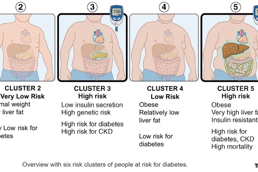 Normal glucose regulation (NGR) for prediabetes remission - Sciencemission