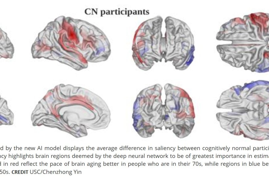 Deep learning to quantify the pace of brain aging - Sciencemission