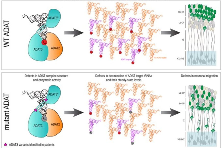 ADAT3 variants disrupt the activity of the ADAT tRNA 2 deaminase ...