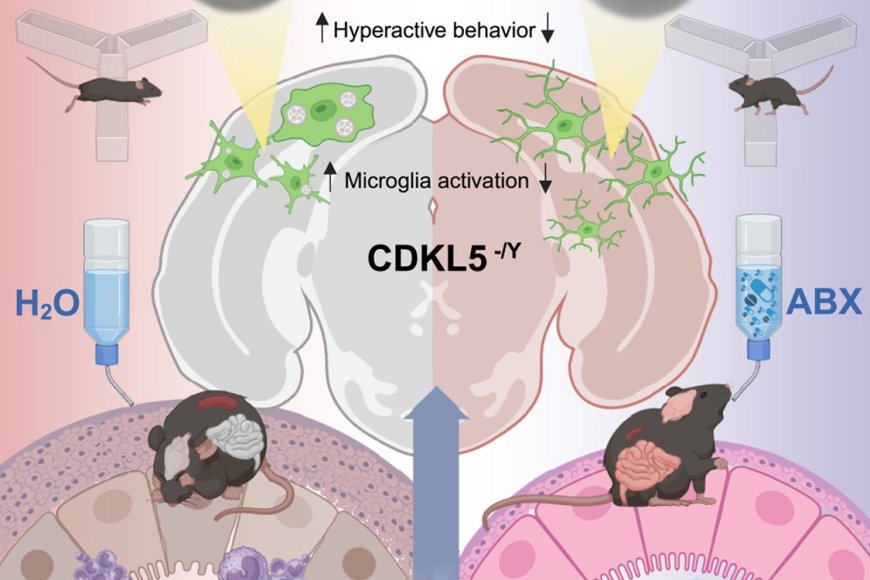 Targeting gut microbiota in CDKL5 deficiency disorder - Sciencemission