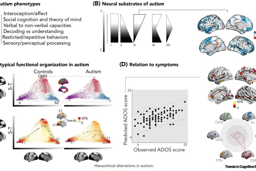 Brain’s information processing hierarchy shift in autism - Sciencemission