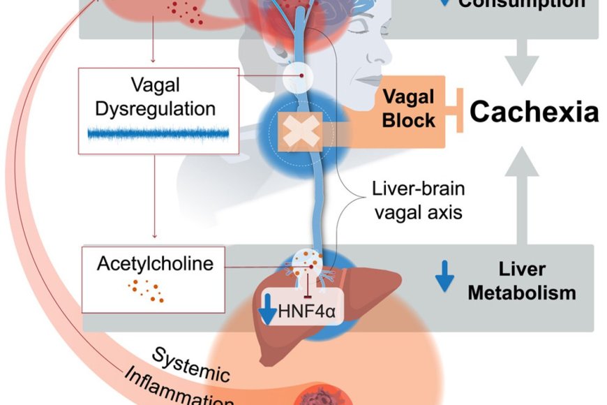 Targeting vagal brain-liver axis to combat cancer-associated cachexia ...