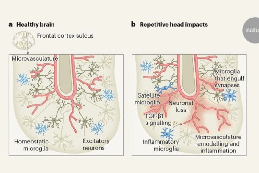 Repeated head trauma causes neuron loss and inflammation in young ...