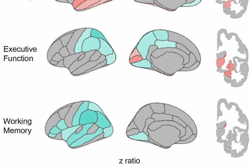 Age-related constraints on the spatial geometry of the brain ...