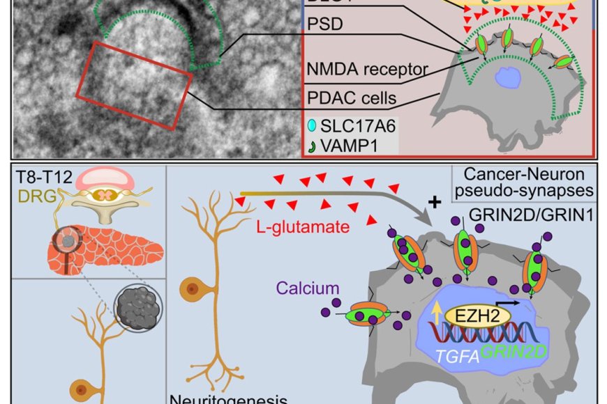 Sensory neurons drive pancreatic cancer progression through ...